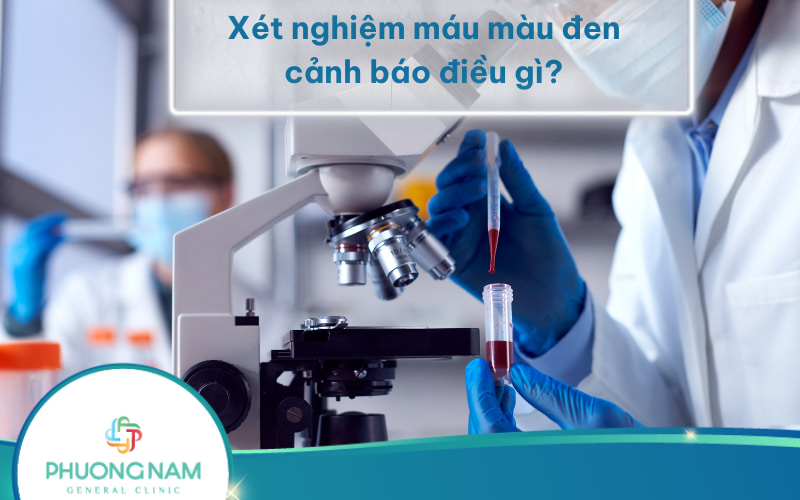 Xét nghiệm máu màu đen cảnh báo điều gì? Và Biện pháp phòng tránh bệnh ...