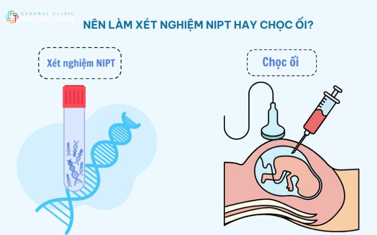 Nên làm xét nghiệm NIPT hay chọc ối? Ưu và nhược điểm của mỗi phương pháp